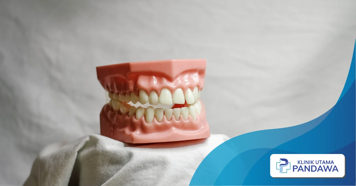 Gigi Tonggos: Penyebab, Dampak, dan Solusi - Klinik Utama Pandawa