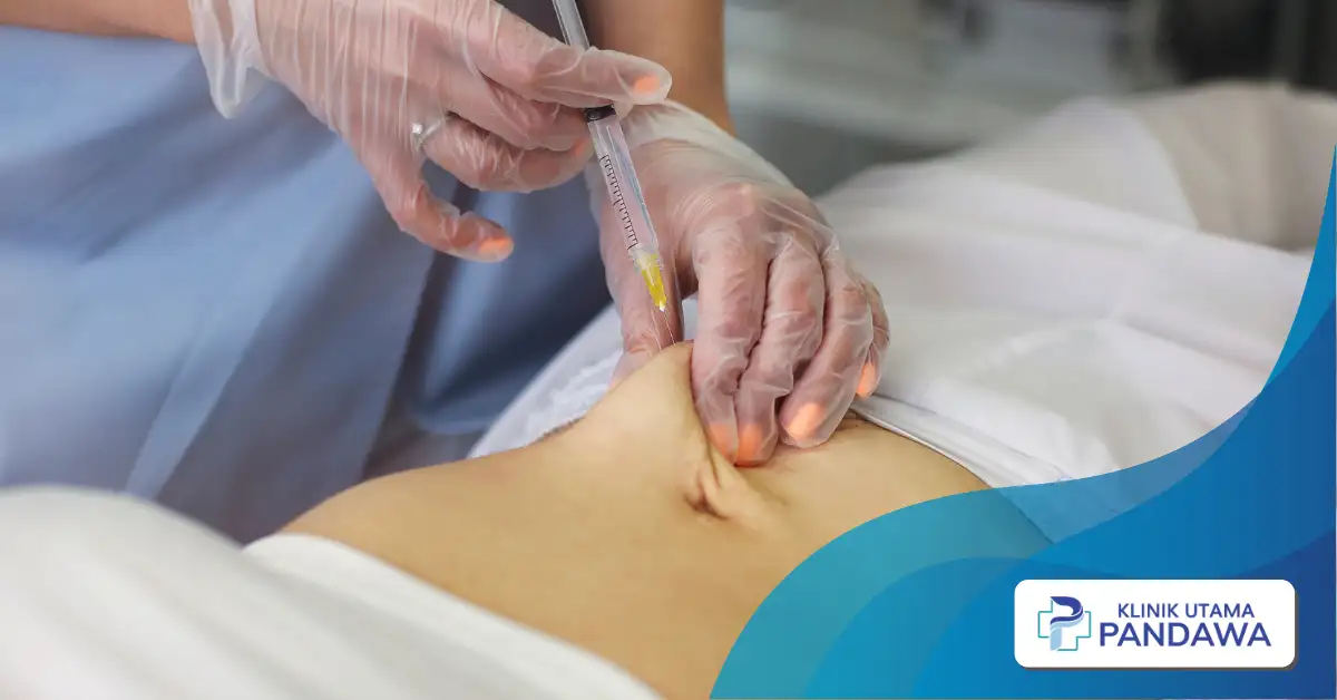 Lipolysis Injection: Solusi Efektif untuk Kurangi Lemak Anda - Klinik ...