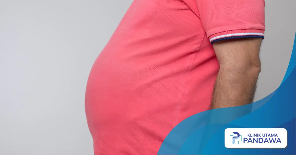 Perut Buncit Mengganggu? Kenali Jenisnya dan Atasi Sekarang! - Klinik ...