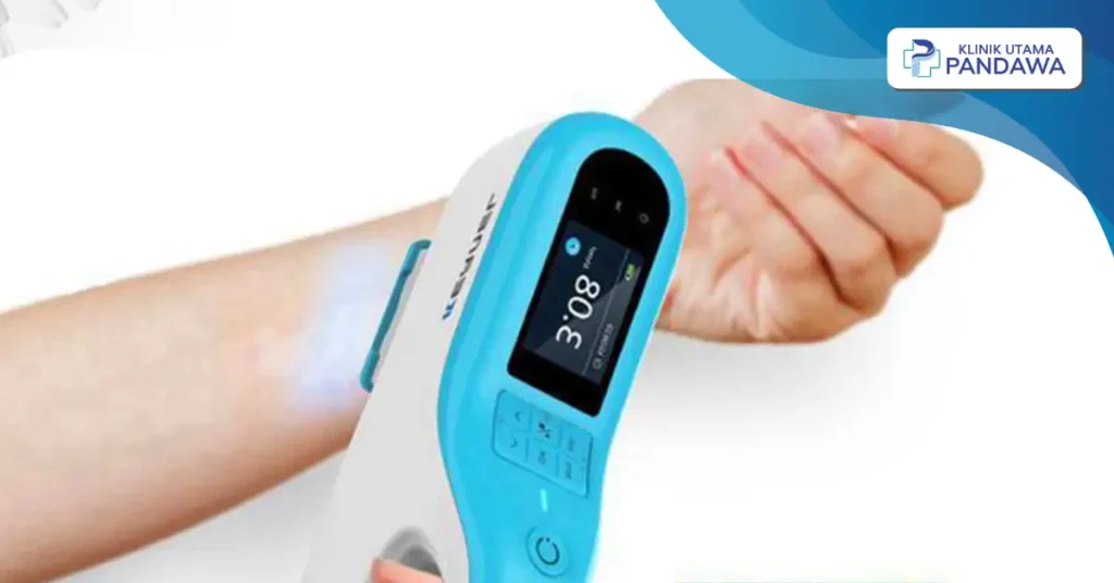 Biaya Terapi Excimer untuk Masalah Kulit Membandel di Klinik Jakarta ...